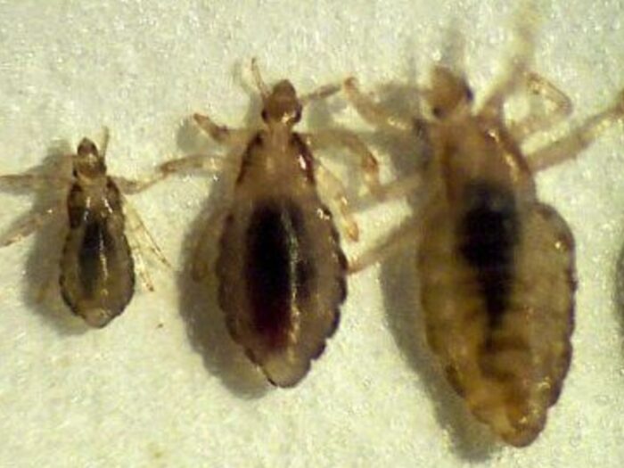 Ini Mitos Kutu Rambut yang Masih Dipercaya